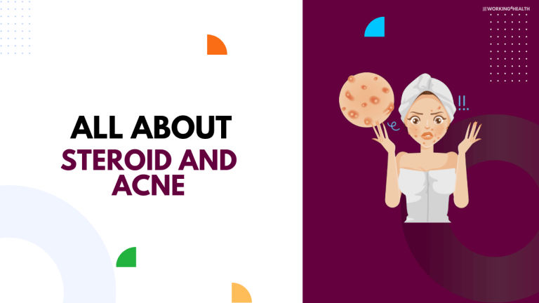 Steroid And Acne: How Are They Related? - Working for Health