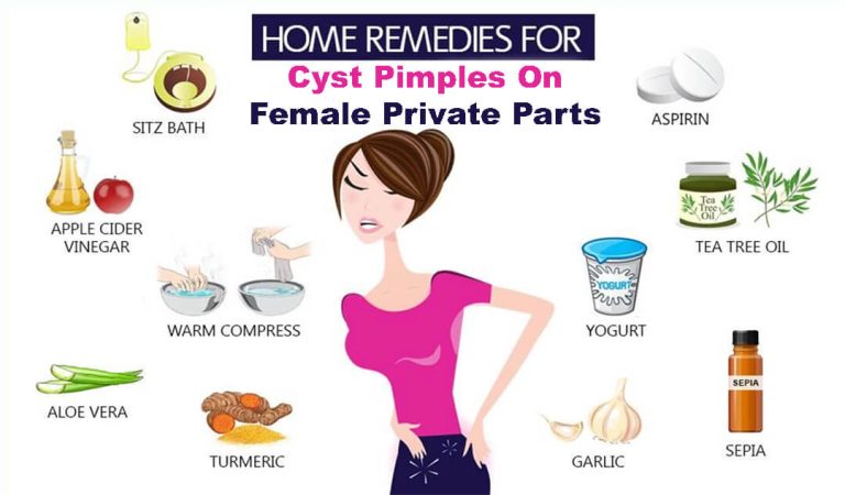 Cyst Pimples On Female Private Parts: 8 Home Remedies - Working for Health